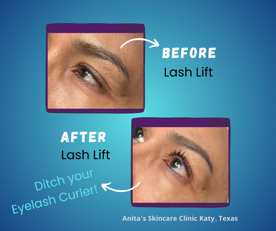 Lash Lift vs. Lash Extensions: A Comprehensive Guide for Beautiful, Low ...
